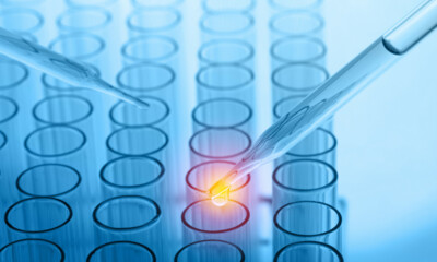 Ovarian Cancer Research Alliance | OCRA